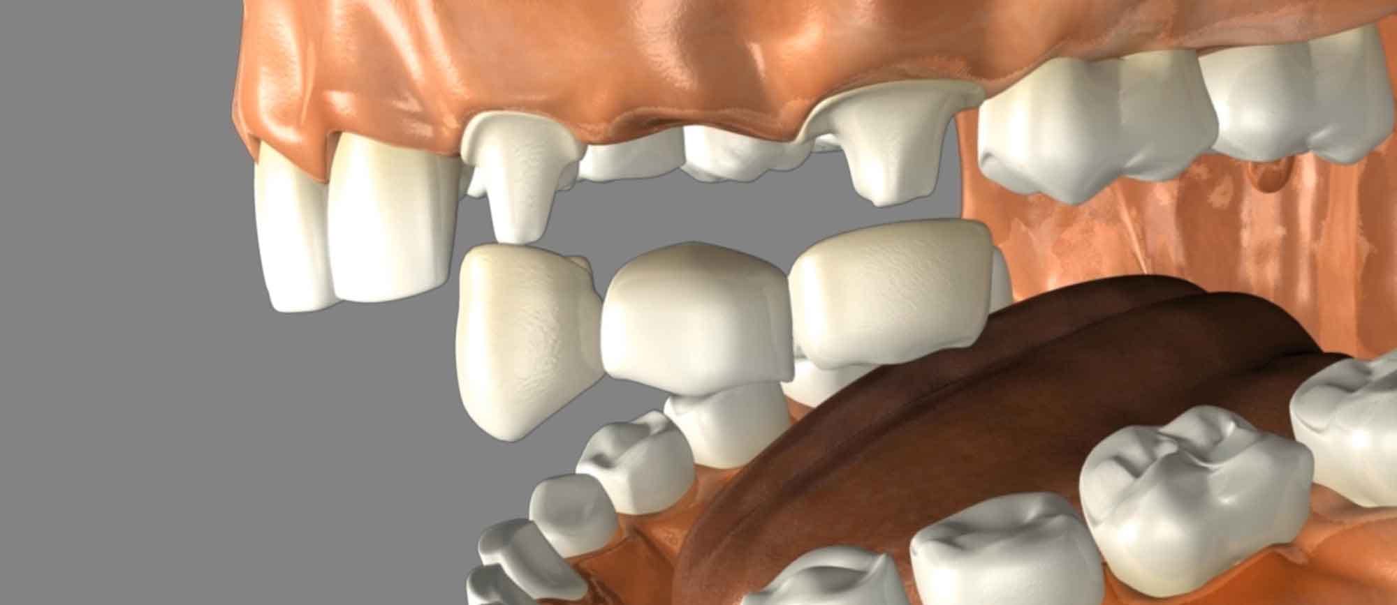 Bradburn Dentistry | Clayton